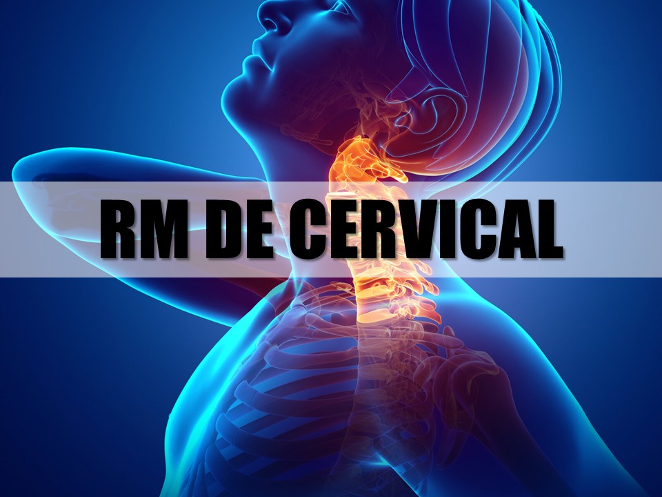 Imágenes Airis Elite - Anato Imagen